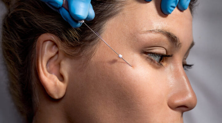 Threads Versus Fillers: Comparing the Pros and Cons of Nose Fillers and ...